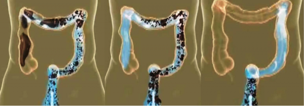Understanding your colon - Colon Health Centre Colonic Hydrotherapy